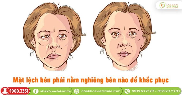 Mặt lệch bên phải thì nhai bên nào? 3 cách khắc phục mặt lệch