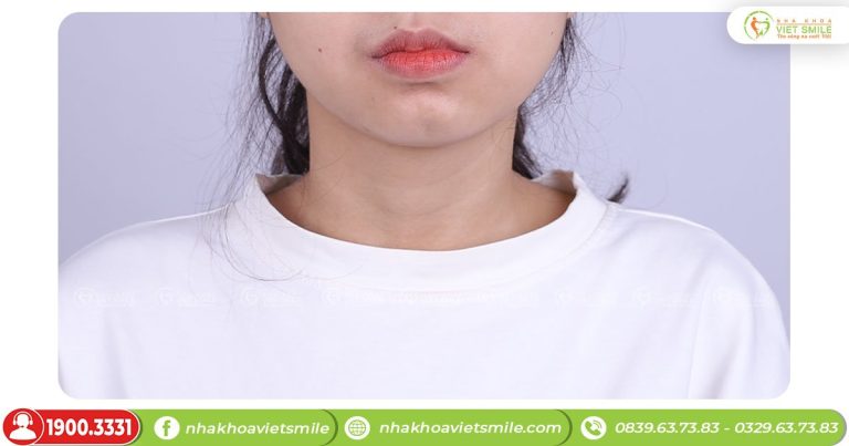 Mặt lệch bên phải thì nhai bên nào? 3 cách khắc phục mặt lệch