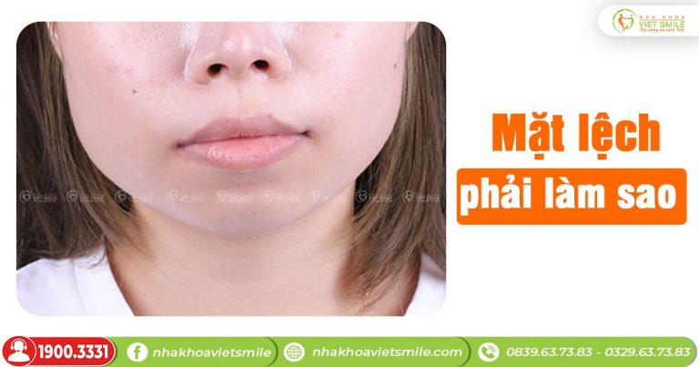 Mặt lệch bên phải thì nhai bên nào? 3 cách khắc phục mặt lệch