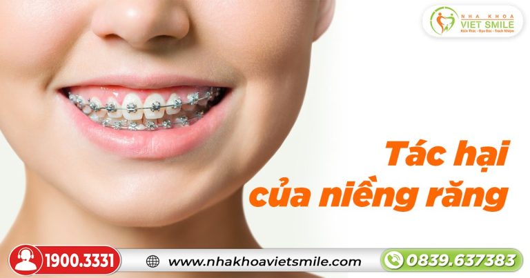 Tác hại của niềng răng