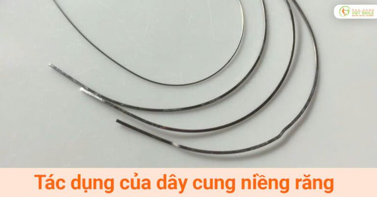 Dây cung niềng răng bị cong có sao không?